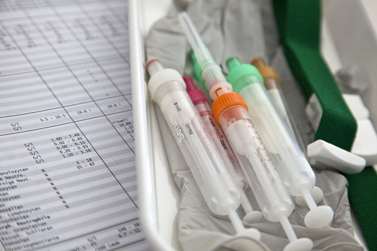 Blutanalyse bilder – Bläddra bland 271 stockfoton, vektorer och videor ...