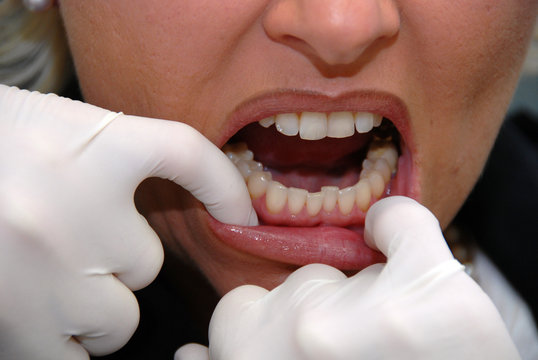 รูปภาพZahnhals – เลือกดูภาพถ่ายสต็อก เวกเตอร์ และวิดีโอ90 | Adobe Stock