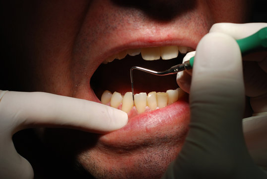 「Zahnhals」の画像 - 85 件の Stock 写真、ベクターおよびビデオ | Adobe Stock