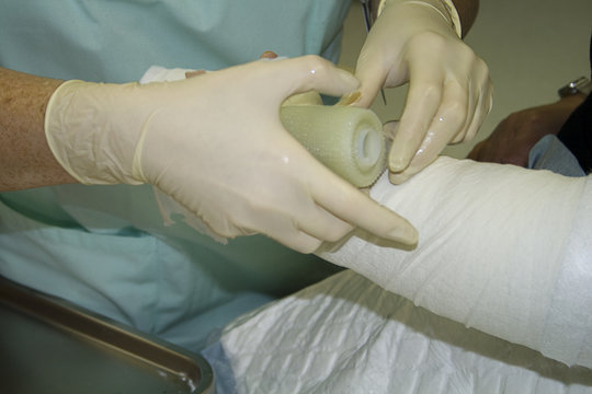 รูปภาพGipsarm – เลือกดูภาพถ่ายสต็อก เวกเตอร์ และวิดีโอ134 | Adobe Stock