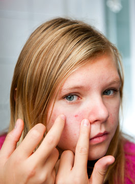 「Pickel」の写真素材 | 1,986件の無料イラスト画像 | Adobe Stock