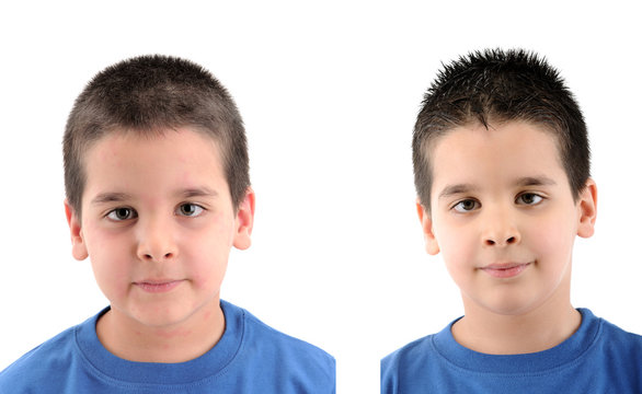 Mumps Bilder – Durchsuchen 6,162 Archivfotos, Vektorgrafiken und Videos ...