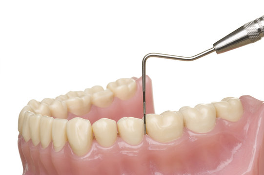 Zahnfleischtaschen Images – Browse 43 Stock Photos, Vectors, and Video ...