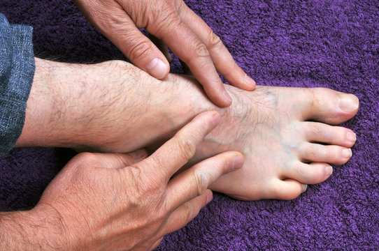 「Foulure」の画像 - 75 件の Stock 写真、ベクターおよびビデオ | Adobe Stock