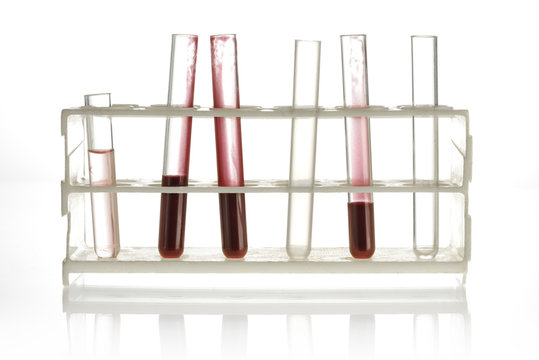 「Provette」の写真素材 | 556件の無料イラスト画像 | Adobe Stock