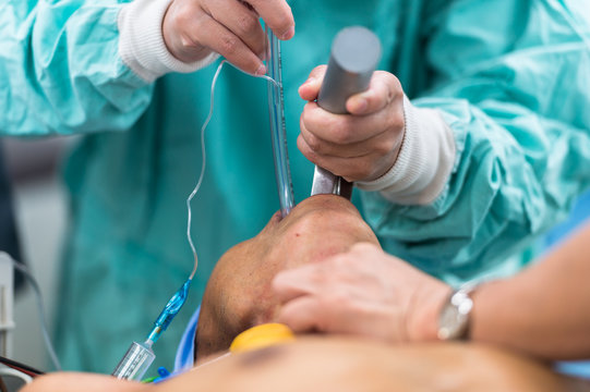 รูปภาพIntubation – เลือกดูภาพถ่ายสต็อก เวกเตอร์ และวิดีโอ4,521 | Adobe ...