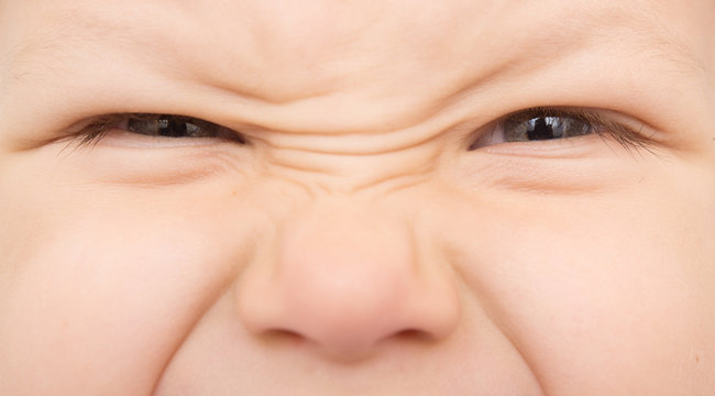 Strabismus Baby Bilder – Durchsuchen 2,163 Archivfotos, Vektorgrafiken ...
