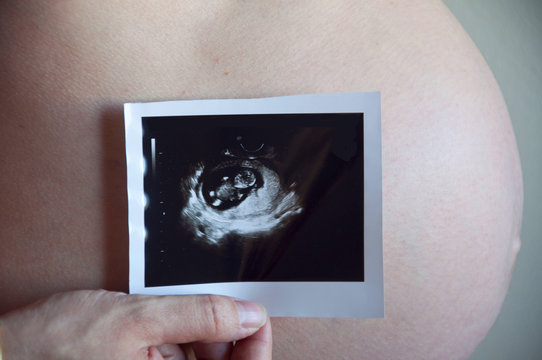 Ecography Images – Browse 1,160 Stock Photos, Vectors, and Video ...