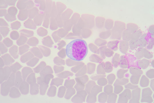 รูปภาพMetamyelocyte – เลือกดูภาพถ่ายสต็อก เวกเตอร์ และวิดีโอ142 | Adobe ...