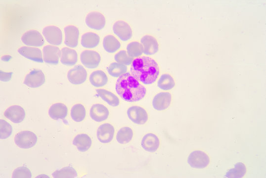 รูปภาพMetamyelocyte – เลือกดูภาพถ่ายสต็อก เวกเตอร์ และวิดีโอ142 | Adobe ...