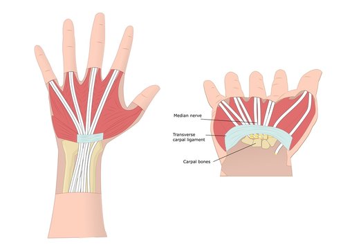 รูปภาพCarpale – เลือกดูภาพถ่ายสต็อก เวกเตอร์ และวิดีโอ6 | Adobe Stock