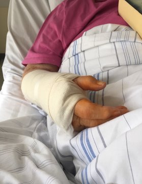 Gipsarm-Bilder: Stock-Fotos & -Videos. | Adobe Stock