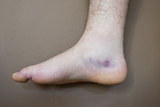 รูปภาพUraz – เลือกดูภาพถ่ายสต็อก เวกเตอร์ และวิดีโอ353 | Adobe Stock