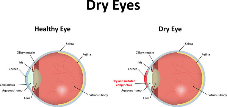 Conjunctiva Diagram