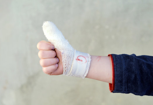 「Daumenverband」の写真素材 | 2件の無料イラスト画像 | Adobe Stock