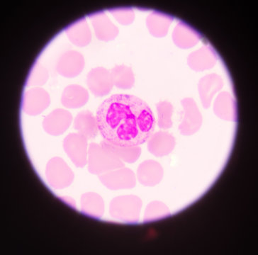 รูปภาพMacrocyte – เลือกดูภาพถ่ายสต็อก เวกเตอร์ และวิดีโอ265 | Adobe Stock