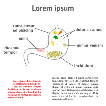 Gastroduodenitis Images – Browse 38 Stock Photos, Vectors, and Video ...