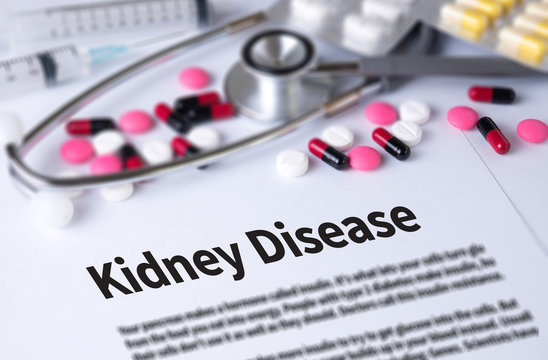 「Nephroptosis」の画像 - 143 件の Stock 写真、ベクターおよびビデオ | Adobe Stock