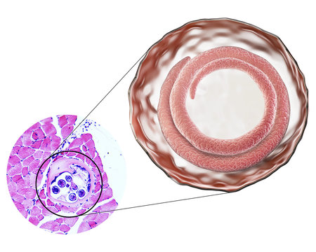 Obrazy (Trichinosis) — zdjęcia, wektory i wideo bez tantiem (357 ...