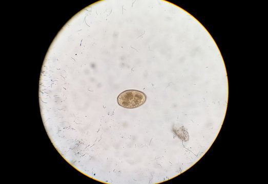 Poop Under Microscope Images – Browse 331 Stock Photos, Vectors, and ...