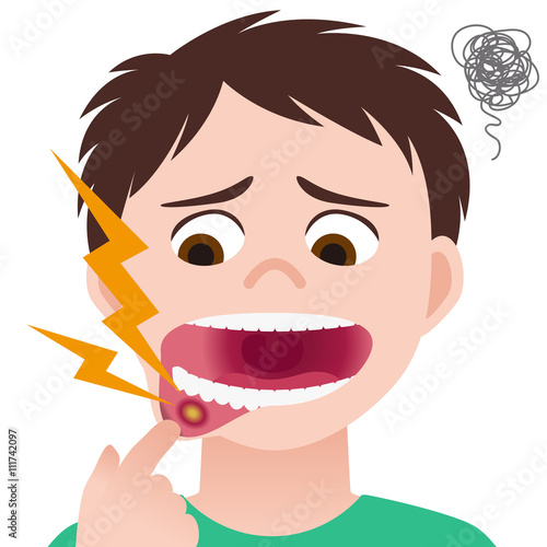"stomatitis, mouth ulcer, inflammation of the oral mucosa, image ...