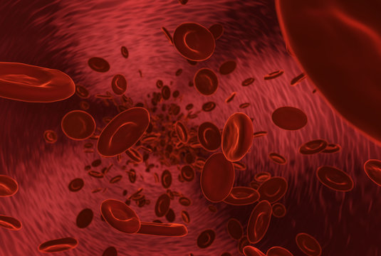 Blutplasma bilder – Bläddra bland 278 stockfoton, vektorer och videor ...