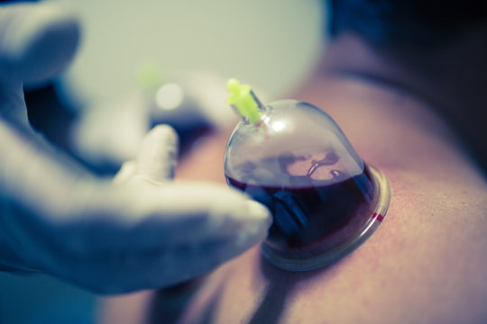 Bentusa Bilder – Durchsuchen 68 Archivfotos, Vektorgrafiken und Videos ...