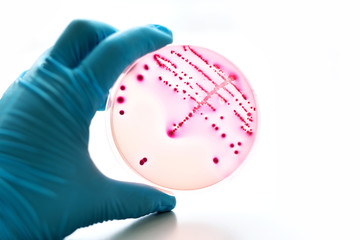 Search photos acinetobacter