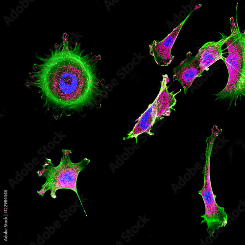 "Immunofluorescence of multiple tumor cells grown in tissue culture ...