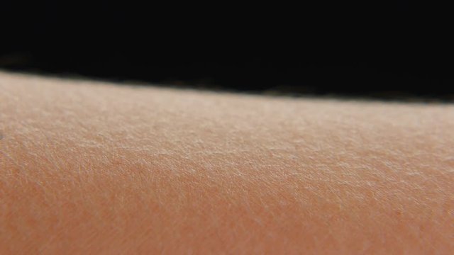 Piloerection Images – Parcourir 2,416 le catalogue de photos, vecteurs ...