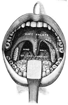 Gaumenmandeln Bilder – Durchsuchen 320 Archivfotos, Vektorgrafiken und ...