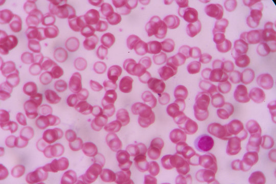 รูปภาพSpherocyte – เลือกดูภาพถ่ายสต็อก เวกเตอร์ และวิดีโอ231 | Adobe Stock