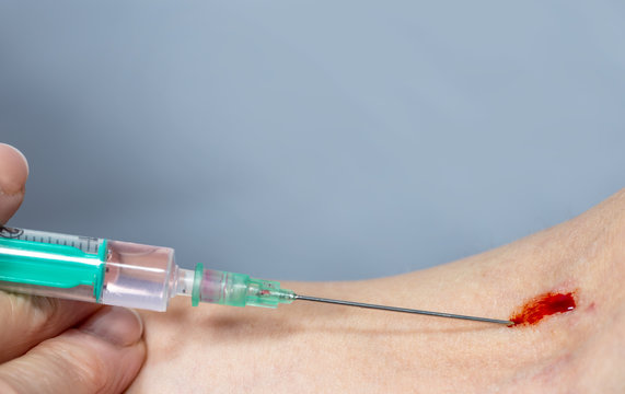 รูปภาพInjektionsnadel – เลือกดูภาพถ่ายสต็อก เวกเตอร์ และวิดีโอ537 ...