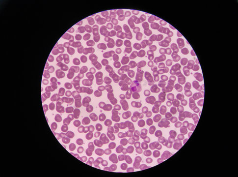 Poikilocyte Bilder – Durchsuchen 89 Archivfotos, Vektorgrafiken und Videos | Adobe Stock