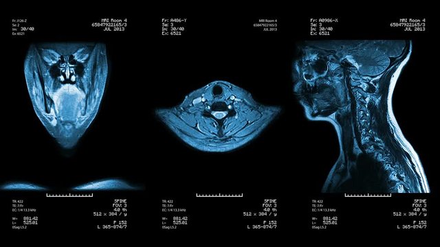 "Mri Scan" Images – Browse 81,502 Stock Photos, Vectors, and Video ...