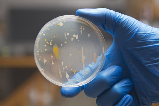 รูปภาพMicrobial – เลือกดูภาพถ่ายสต็อก เวกเตอร์ และวิดีโอ13,391 | Adobe ...