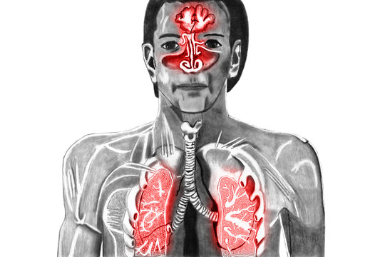 Imágenes de Katarrh: descubre bancos de fotos, ilustraciones, vectores ...