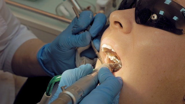 "Tooth Stone"-Bilder: Stock-Fotos & -Videos. | Adobe Stock