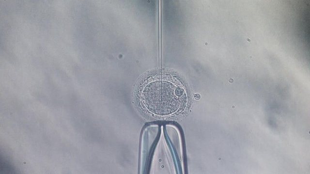 Icsi Bilder – Durchsuchen 491 Archivfotos, Vektorgrafiken und Videos ...