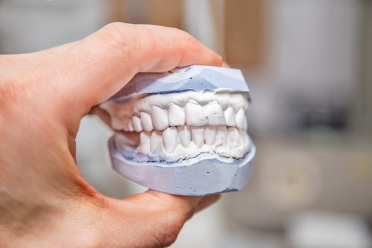 「Orthodontal」の画像 - 1,463 件の Stock 写真、ベクターおよびビデオ | Adobe Stock