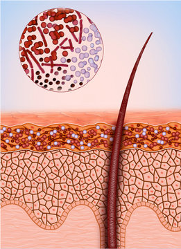 Intertrigo Images – Browse 57 Stock Photos, Vectors, and Video | Adobe ...