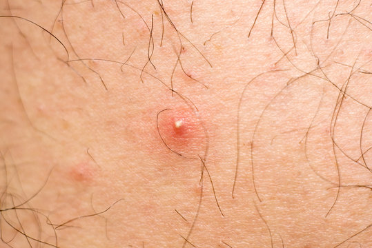 Papula Bilder – Durchsuchen 192 Archivfotos, Vektorgrafiken und Videos ...