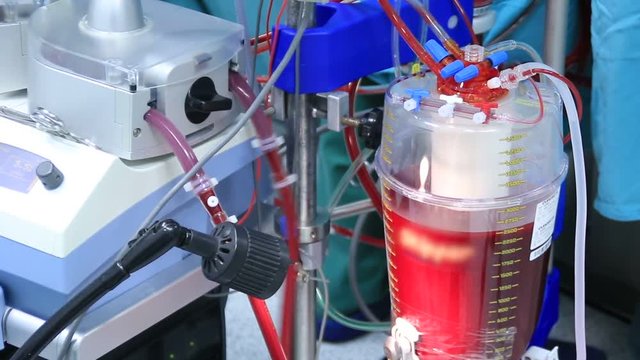 รูปภาพPerfusion – เลือกดูภาพถ่ายสต็อก เวกเตอร์ และวิดีโอ3,067 | Adobe Stock