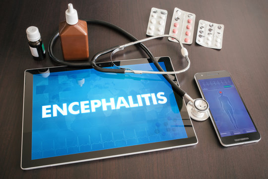 รูปภาพEncephalitis – เลือกดูภาพถ่ายสต็อก เวกเตอร์ และวิดีโอ34,113 ...