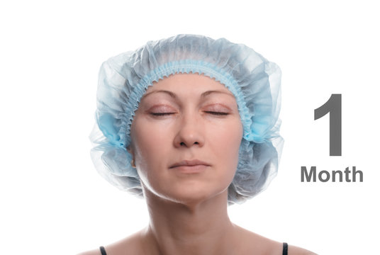 Blepharon Images – Browse 39 Stock Photos, Vectors, and Video | Adobe Stock