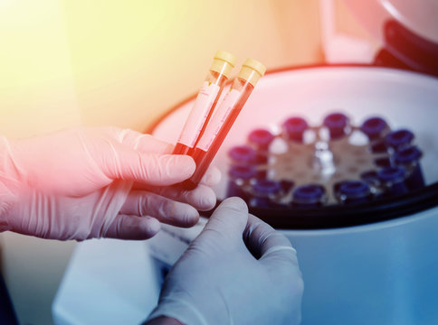 Blutanalyse Bilder – Durchsuchen 165,405 Archivfotos, Vektorgrafiken ...