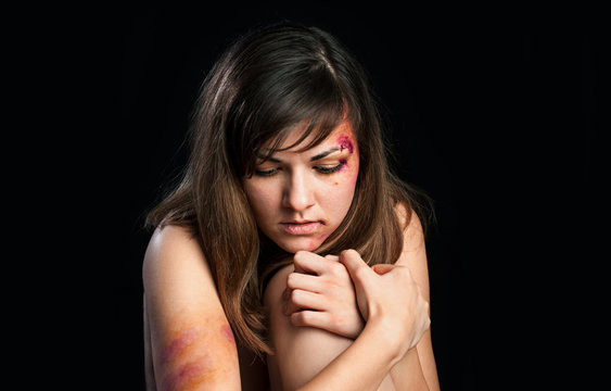 รูปภาพBeaten – เลือกดูภาพถ่ายสต็อก เวกเตอร์ และวิดีโอ729,102 | Adobe Stock