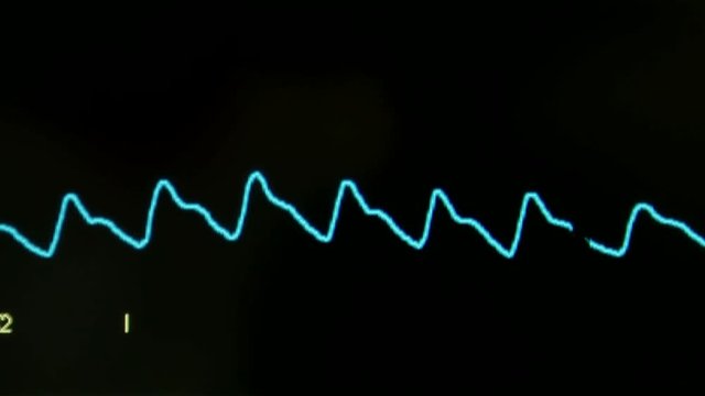 Flat Line Heart Monitor Images – Browse 13,602 Stock Photos, Vectors ...