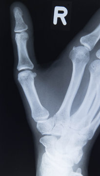 รูปภาพFingergelenk – เลือกดูภาพถ่ายสต็อก เวกเตอร์ และวิดีโอ66 | Adobe Stock