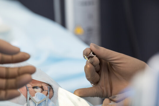 รูปภาพPhaco – เลือกดูภาพถ่ายสต็อก เวกเตอร์ และวิดีโอ331 | Adobe Stock